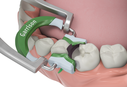Garrison Composi-Tight 3D Fusion Matrix Rings - Green FX600-1 | eBay