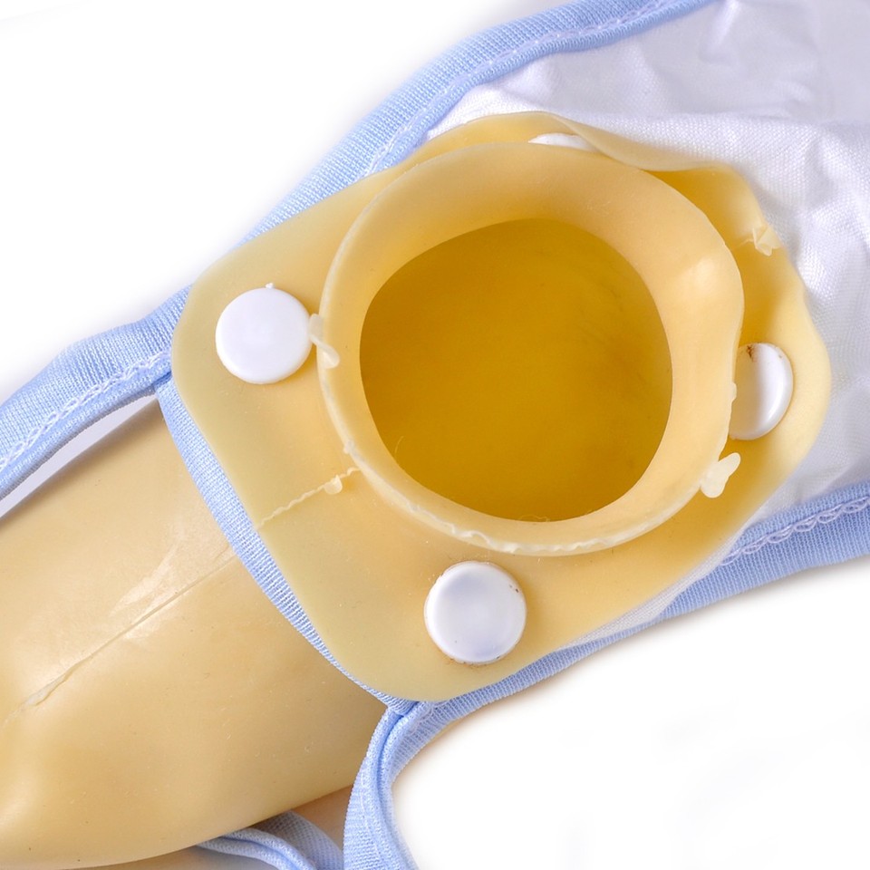 Soft Male Urinal Pee Holder Bag Test 1000ML Bladder Incontinence Aid ...
