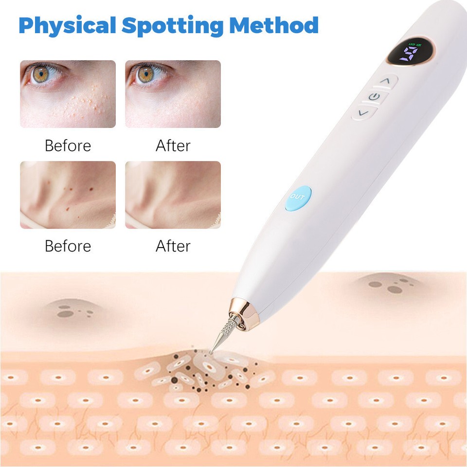 Electric Laser Plasma Pen Mole Removal Dark Spot Remover Skin Wart Tag ...