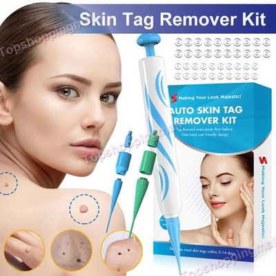 UK 2IN1 Natural Painless Auto SKIN TAG Removal Kit Skin Tag Bands ...