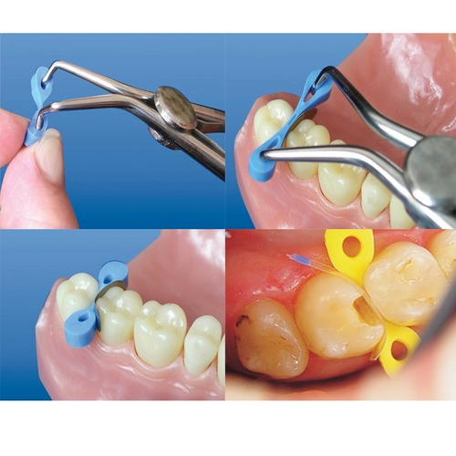 30Pc/Box Dental Transparent Plastic Matrix Sectional Contoured Matrices ...