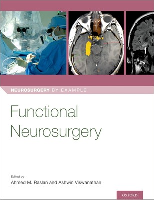 Functional Neurosurgery (Paperback) Neurosurgery by Example (UK IMPORT ...