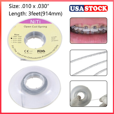 Dental Orthodontic Niti Open Coil Spring Spool Dia.0.10 x 030 " inch ...