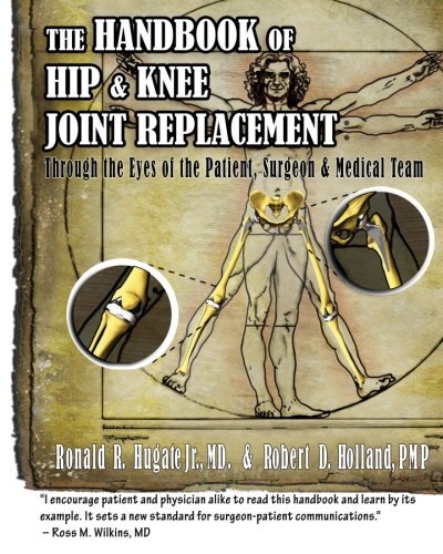 HANDBOOK OF HIP & KNEE JOINT REPLACEMENT: THROUGH THE EYES By Ronald R ...