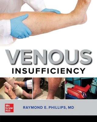Venous Insufficiency by Raymond E. Phillips (English) Paperback Book ...