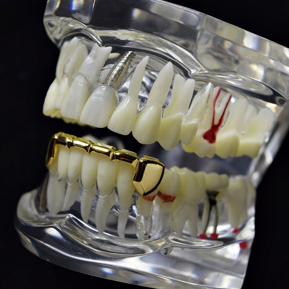 Half Grillz 14k Gold Plated Bottom Lower Grill Slim Bar New Hip Hop ...