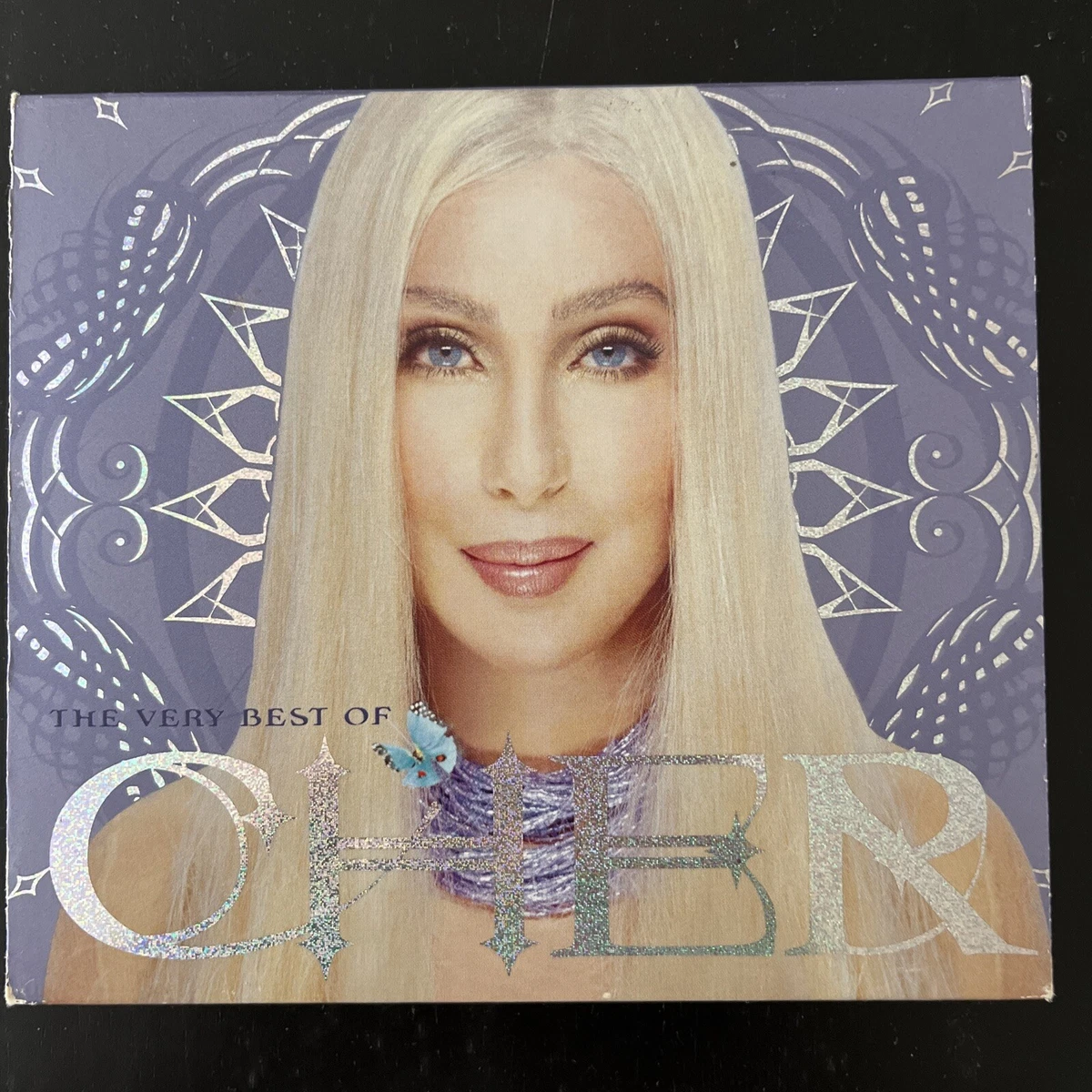 Cher Lloyd Teeth 2022