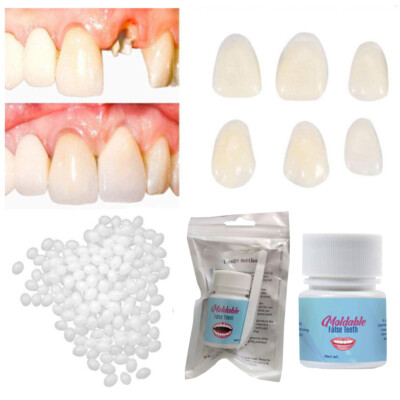 Temporary Tooth Repair Kit Resin Fix Broken False Teeth Fill Gaps ...