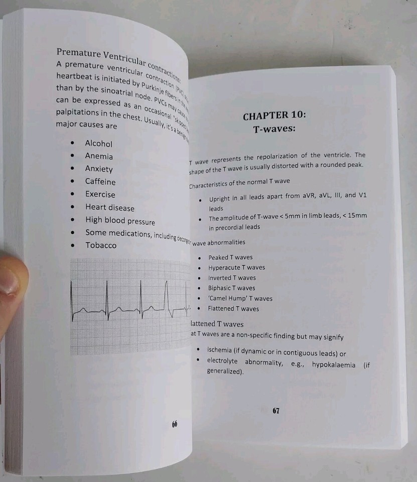 ECG / EKG Interpretation: A Systematic Approach to Read a 12-Lead ECG ...