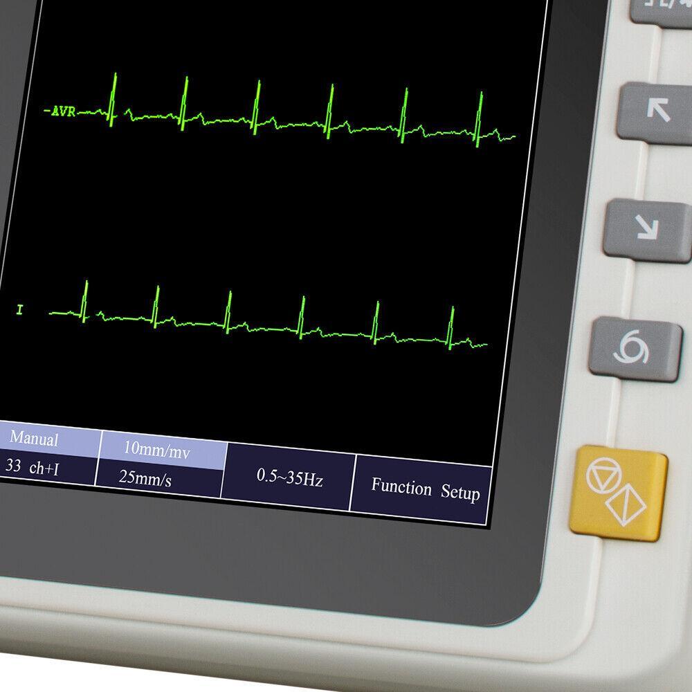 Portable ECG EKG Machine 6 Channel Touch 7 Inch Display 12 Lead ...