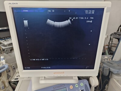 Aloka Alpha 10 IPF 1901 19"monitor | eBay