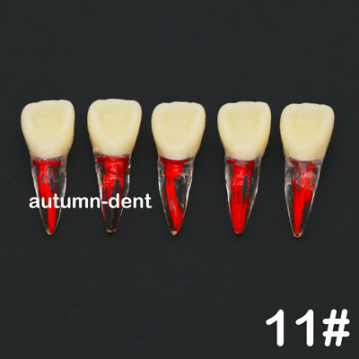5Pcs Dental Endodontic Root Canal RCT Practice Pulp Cavity Endo Teeth ...