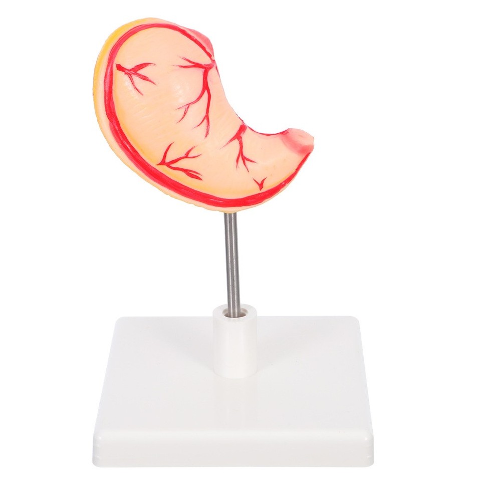 Anatomy for Science Classroom Organ Models Stomach Educational ...