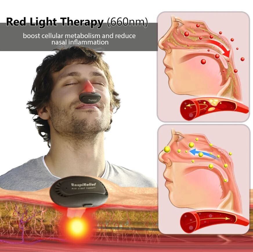 Portable Rhinitis Relief Device - Red Light Therapy for Sinusitis Nasal ...