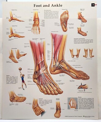 Foot & Ankle Plantar Arch Sprain Anatomy Chart Glossy Print (NOS) c ...