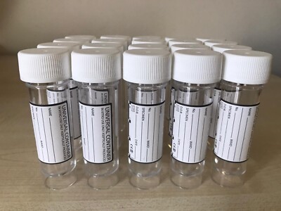 20 x 30ml Universal Urine Sample Bottles Pots Containers Cups | eBay UK