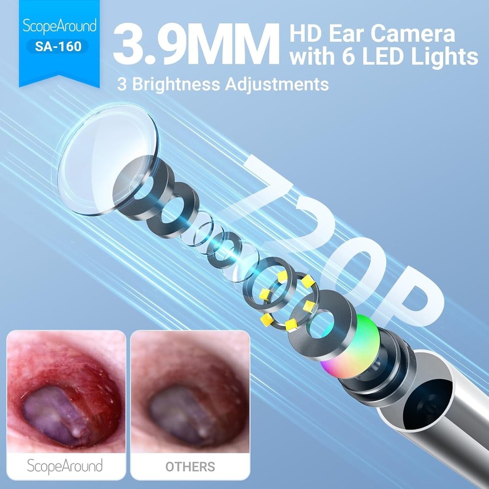 ScopeAround 3.9mm Ear Otoscope Camera with 1.45" IPS Screen Ear Wax ...