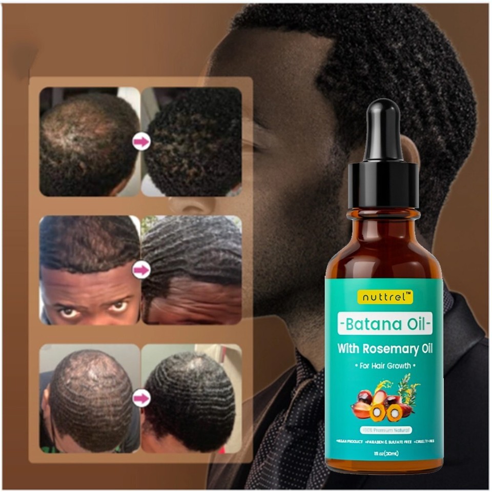 100% Pure Raw Botana Oil for Hair Growth - Dr. Sebi Batana Oil from ...