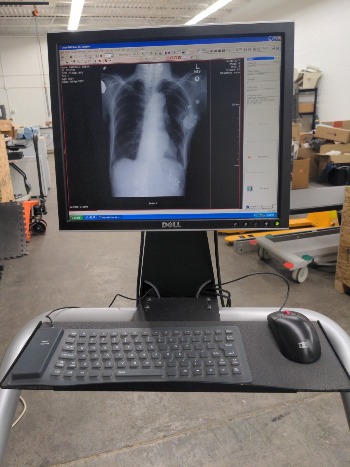 Orex PcCR 1417 CR X-ray System | eBay