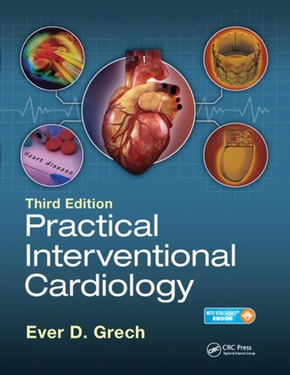 Practical Interventional Cardiology by Ever D. Grech (2020, Trade ...