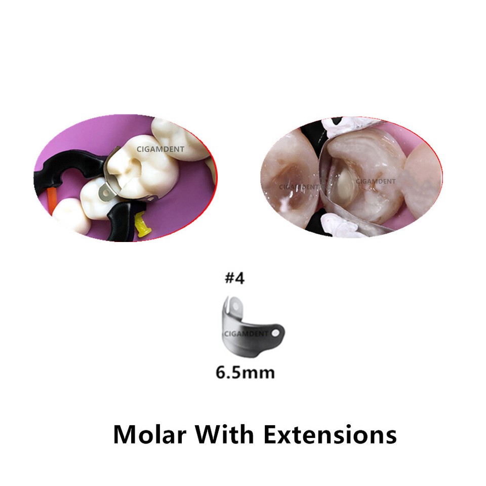 50 Pcs Dental Matrix Bands Palodent V3 Style Sectional Contoured ...