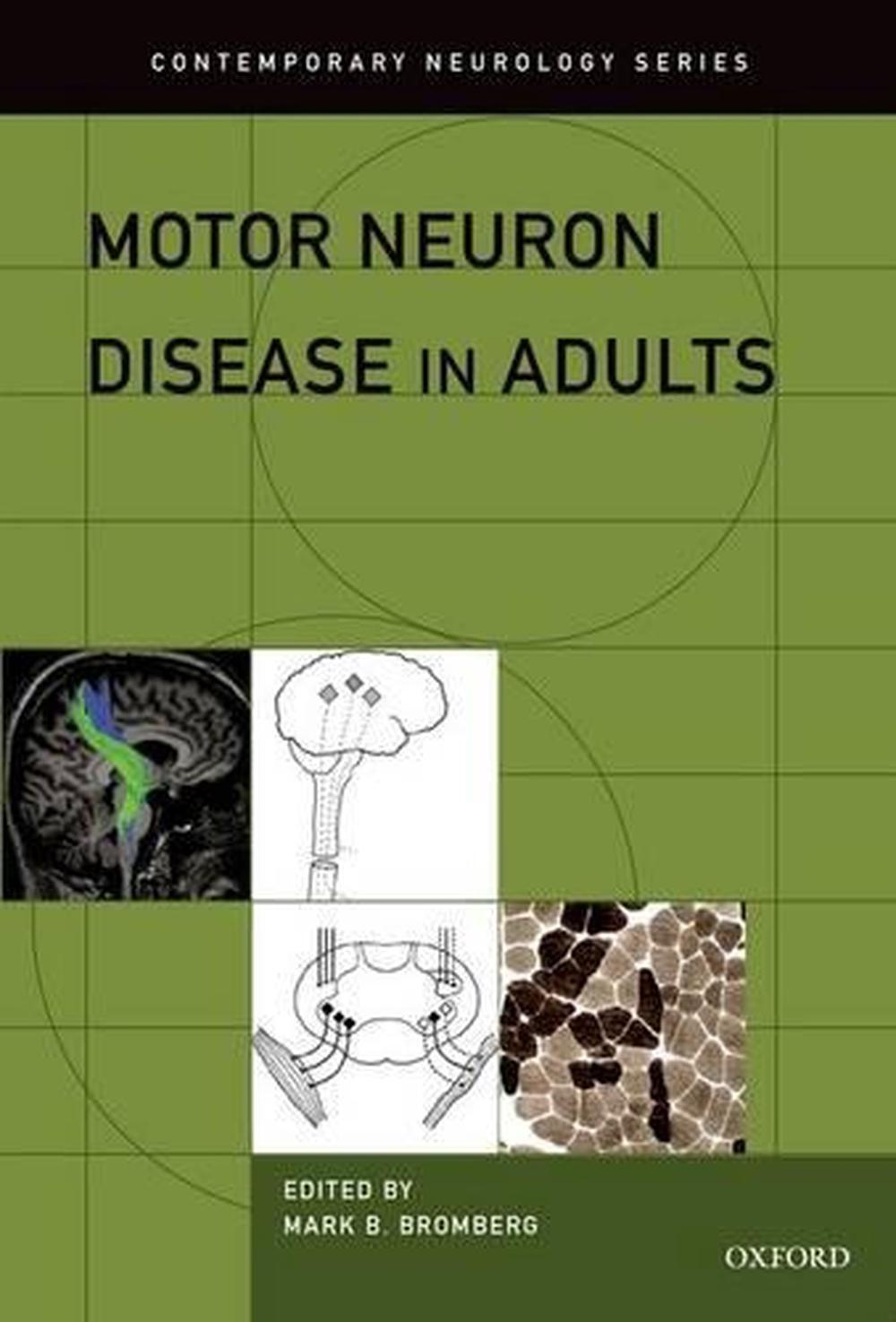 Motor Neuron Disease in Adults by Mark B. Bromberg (English) Hardcover ...