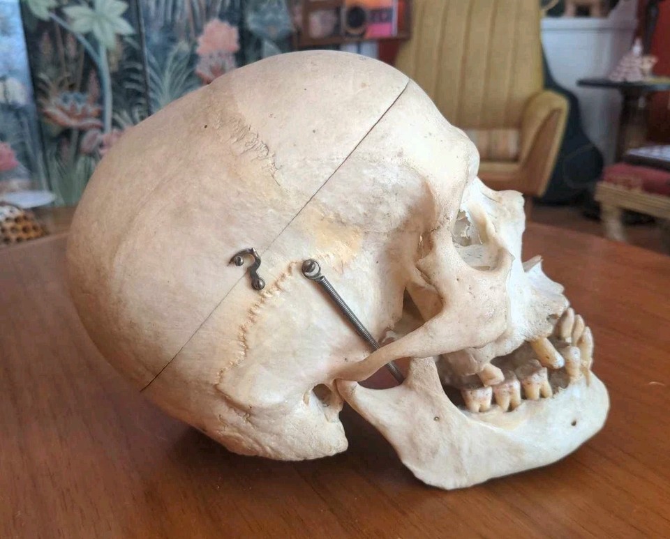 Medical Anatomical Model Human Skull Precision Working Springed Jaw ...