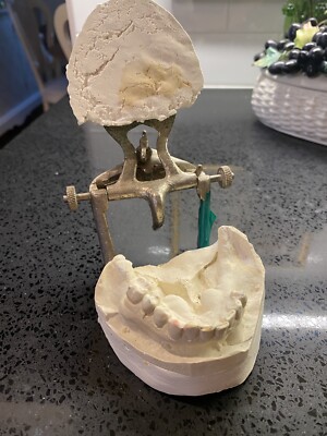 Plaster Dental Model Articulated Vintage Antique | eBay