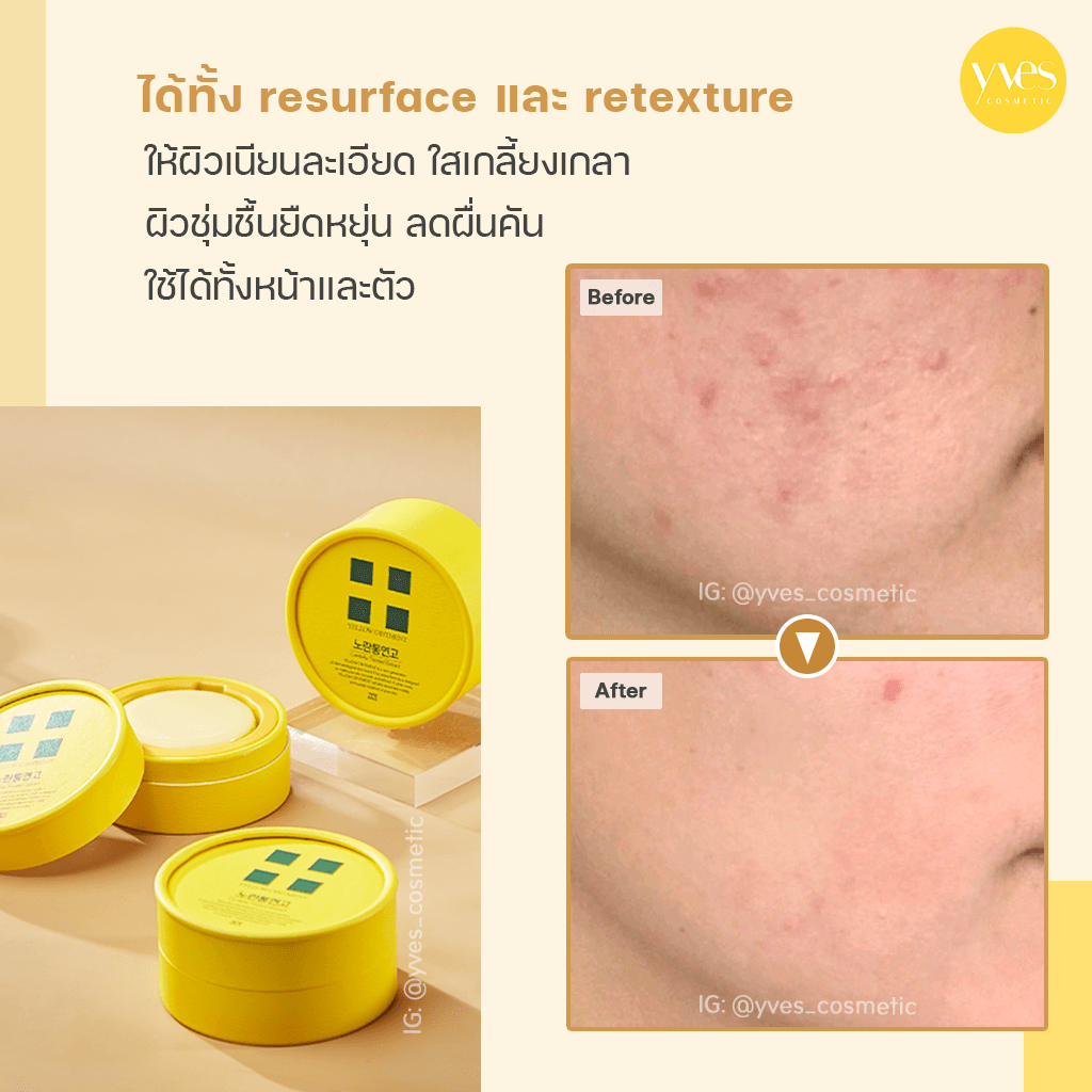 Yellow Ointment Scars Eraser Damaged Skin Smooth Moisturiz Centella K ...