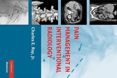 Pain Management in Interventional Radiology by Charles E. Ray, Jr ...