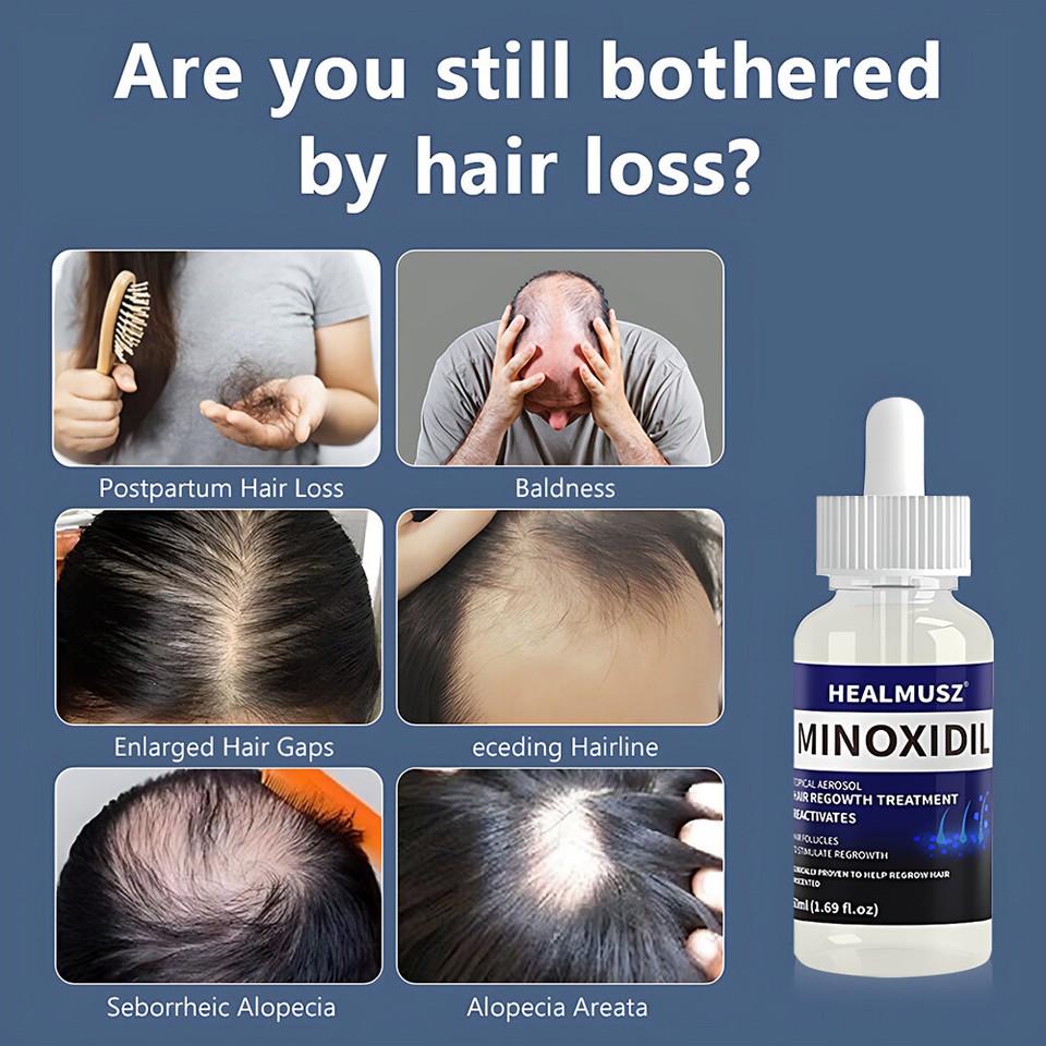 Extra Strength Men Fast Regrowth Scalp Treatment Hair Growth Solution ...