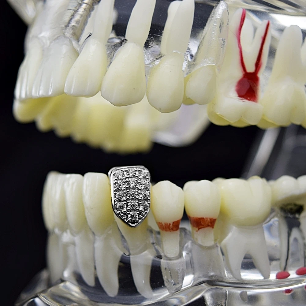 Silver Canine Tooth Cap