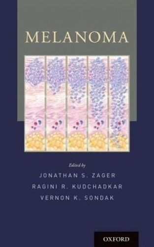 Melanoma by Ragini Kudchadkar, Jonathan S. Zager, Vernon K. Sondak ...