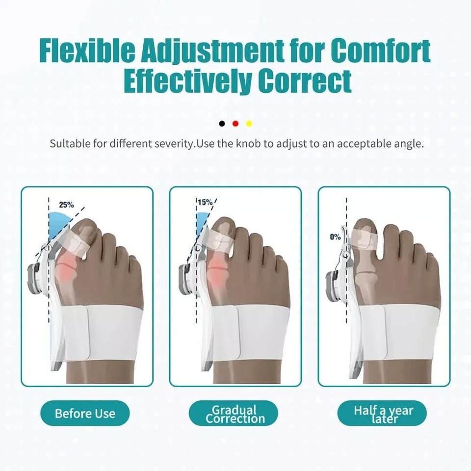 Bunion Fix Toe Valgus Corrector Adjustable Orthosis Women Men Splints ...