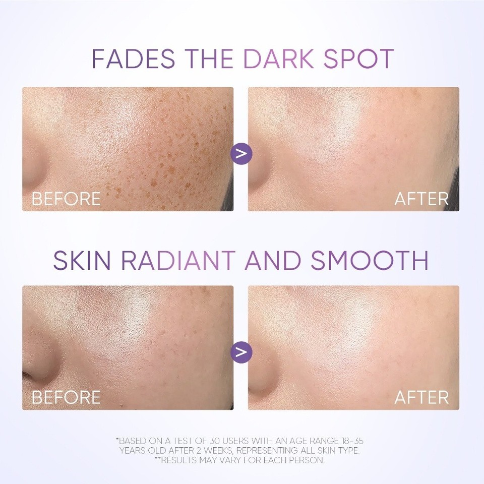 SKINTIFIC Symwhite 377 Dark Spot Acne Scars PIH & PIE Anti-Aging ...