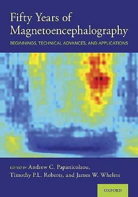 Fifty Years of Magnetoencephalography: Beginnings, Technical Advances ...