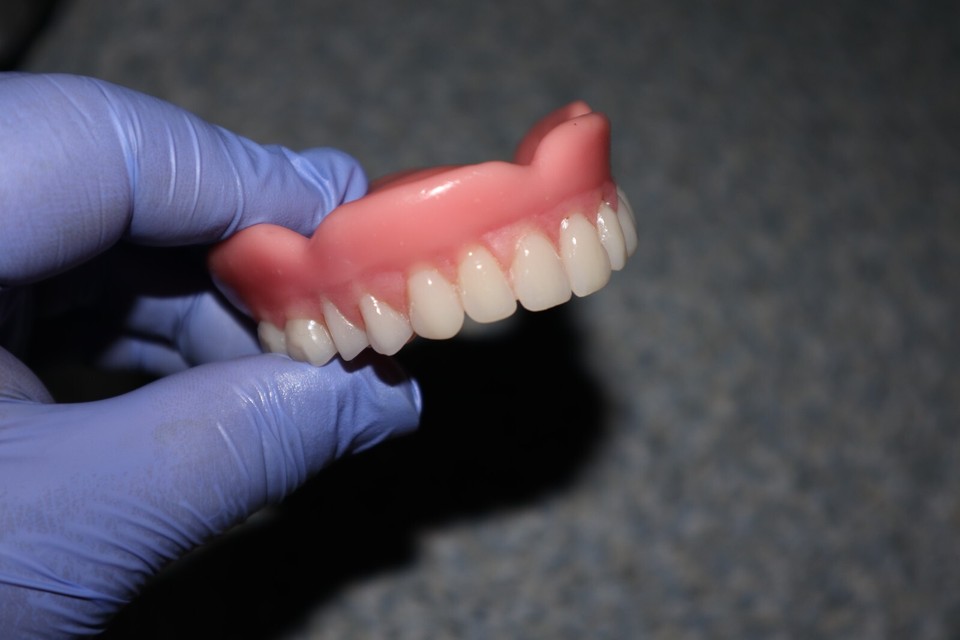 DENTURE Thermo Plast UPPER / BOIL and BITE /Temporary Dentures / DIY ...