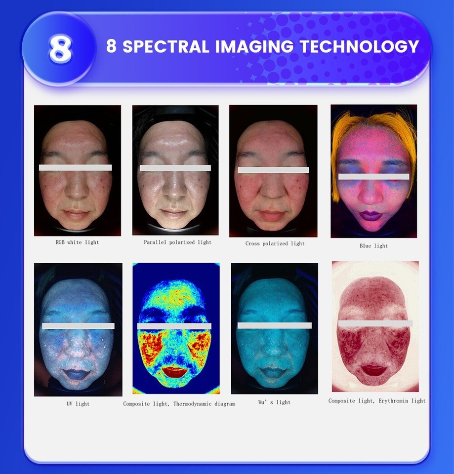 New 3D Skin Scanner Facial Analyzer Intelligent Analysis System Machine ...
