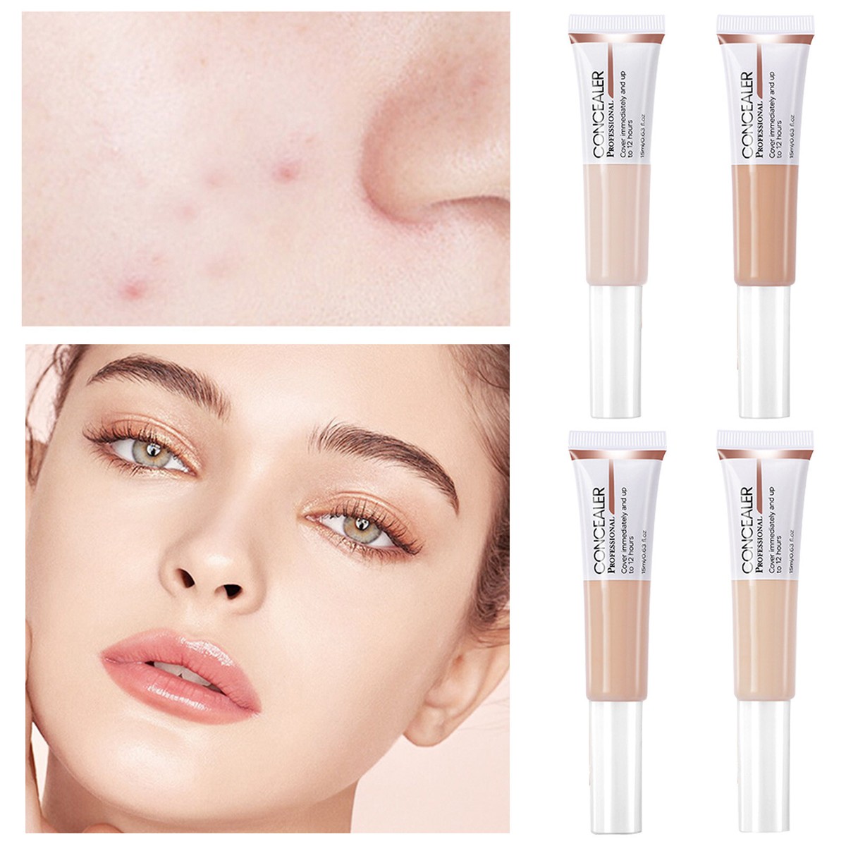 What Color Concealer Covers Acne Scars - Infoupdate.org