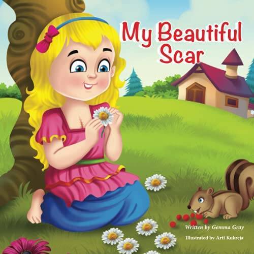 My Beautiful Scar - Paperback By Gray, Mrs Gemma - VERY GOOD | eBay