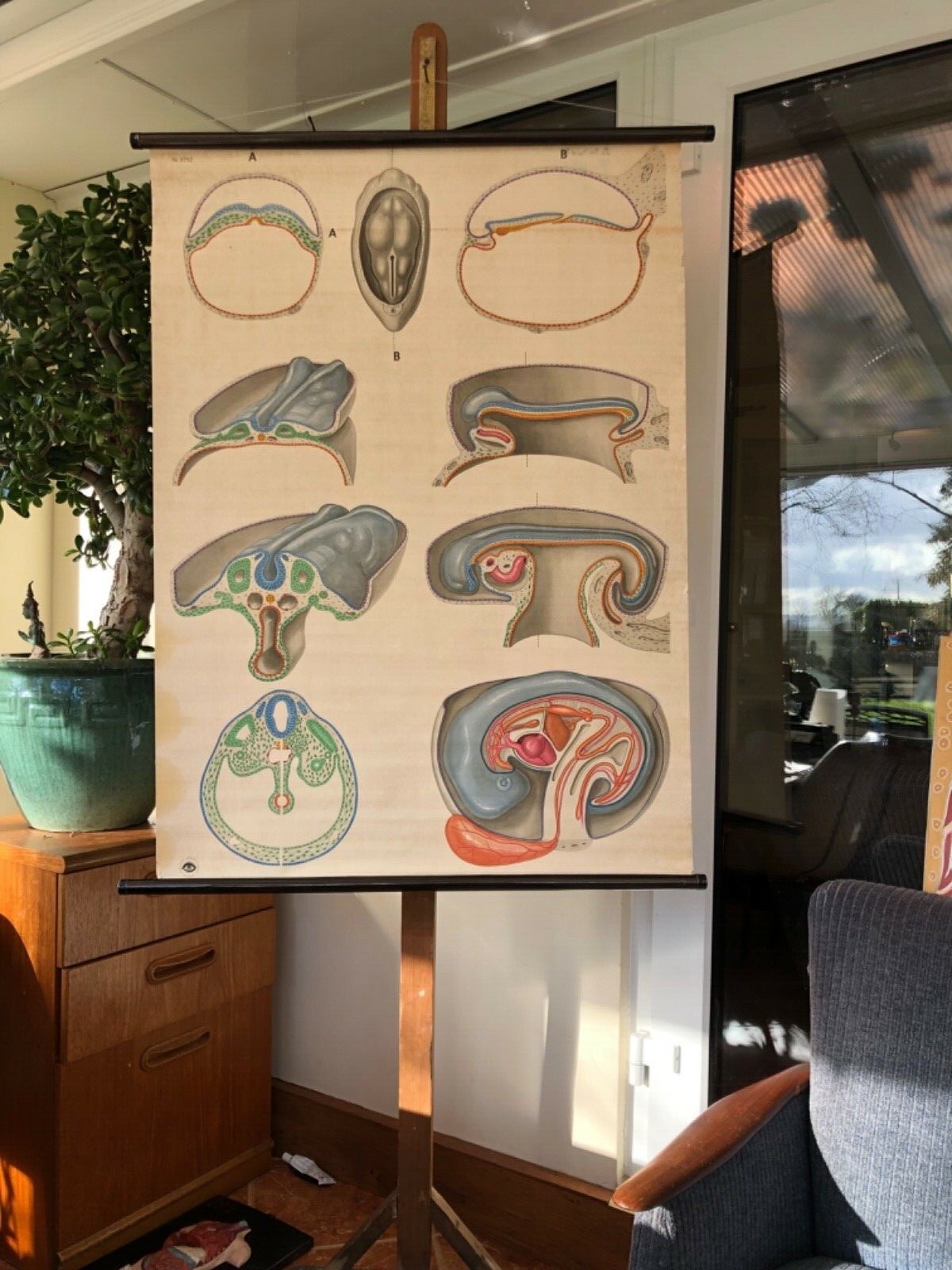 Vintage school chart EMBRYOLOGY midwifery poster ANATOMY educational ...