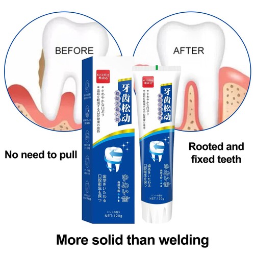 Loose Teeth Care Toothpaste Repair Gingivitis Cavities Prevention ...