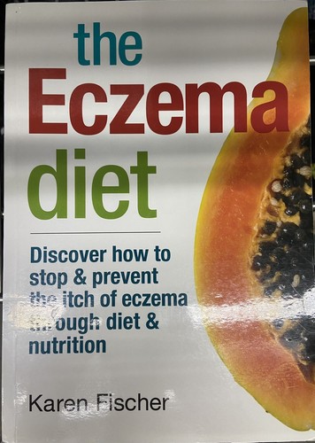 The Eczema Diet: Discover How to Stop and Prevent The Itch of Eczema ...