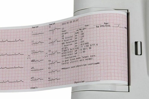 Print Paper roll For CONTEC ECG600G ECG Machine electrocardiograph ...