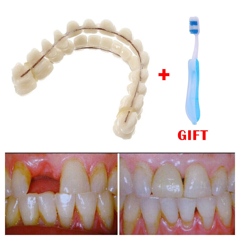 Removable Teeth Covers