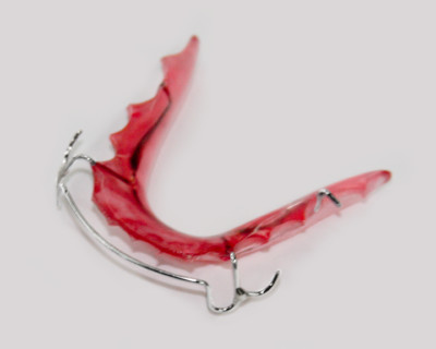 Retainer For Bottom Teeth