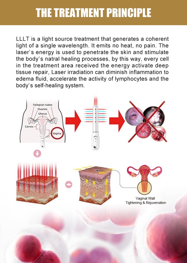 LASTEK Vaginal Tightening Rejuvenation Wand Cervical Rehab Laser ...