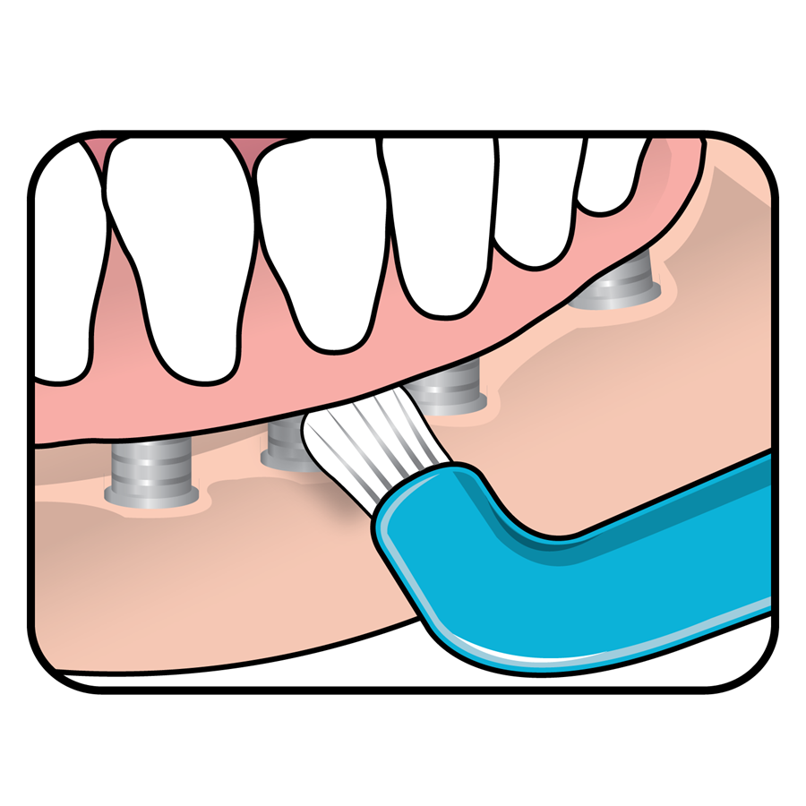 TePe Compact Single Tufted Toothbrush Kids Implants Dentures Braces ...