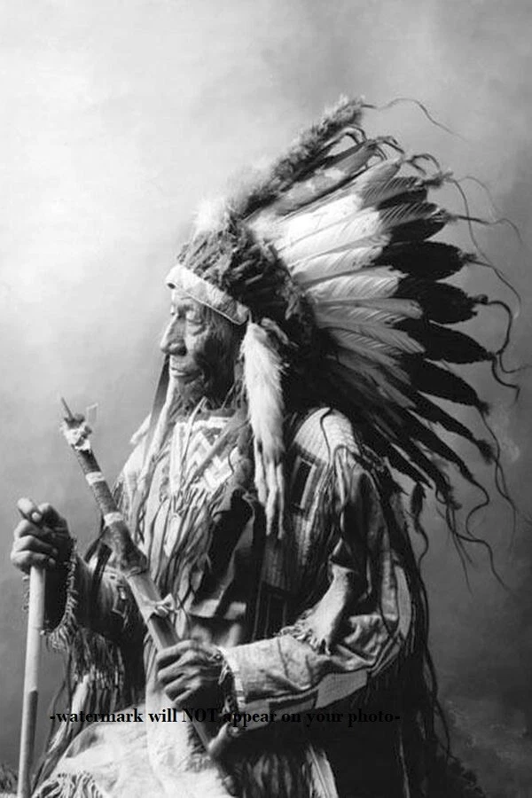 Albino Native American