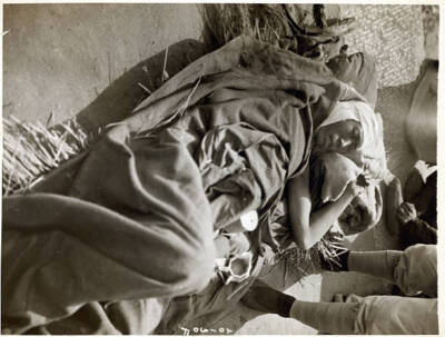 China: A Chinese Nationalist Soldier, Wounded On The Shankaikwan Fro ...